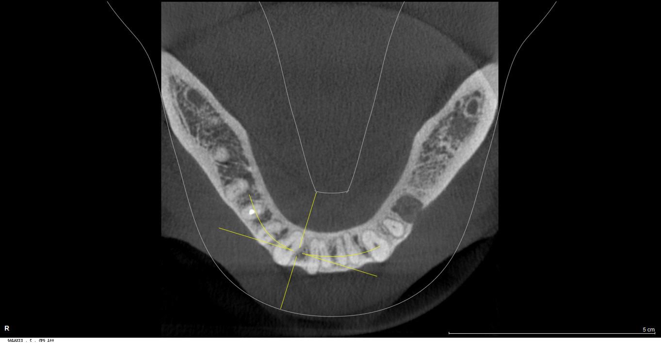 Beispielbilder DVT-Röntgen